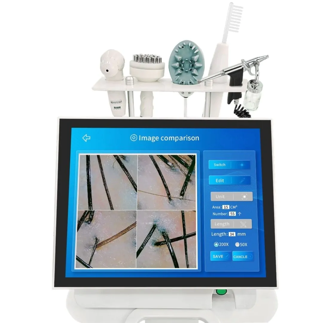Scalp Scope Pro Analysis | HD Before and After System